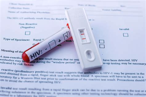 Why Anonymous Hiv Testing In Bangkok Is Important Responsible Shale Development