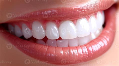 Ai Generated Close Up Of A Bright Smile Showcasing Healthy Teeth