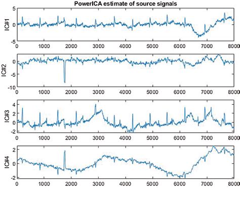 Figure 6 From Design And Realization Of Non Invasive Fetal Ecg Monitoring System Semantic Scholar