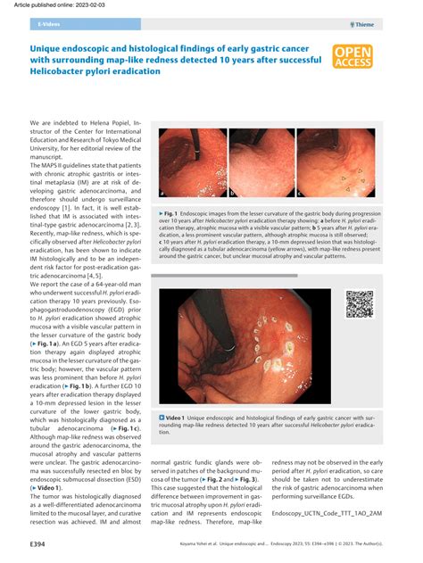 Pdf Unique Endoscopic And Histological Findings Of Early Gastric