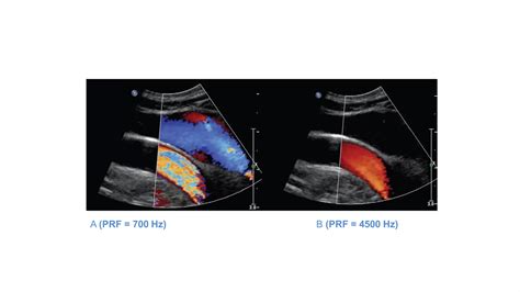 Doppler Physics Ppt PPTX Digital Audio Computer Software And Applications