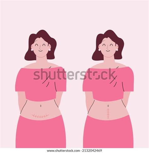 6 Vertical And Horizontal C Section Vector Stock Vectors Images And Vector Art Shutterstock