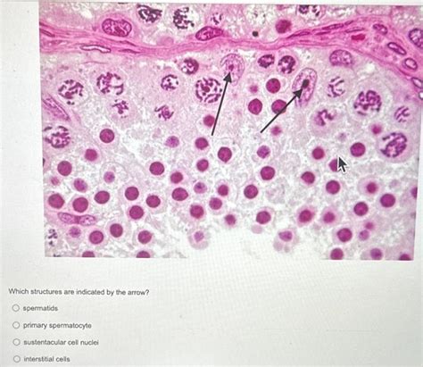 [solved] Which Structures Are Indicated By The Arrow Sper