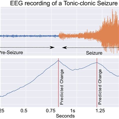 A Scalp Right Central Electrode Recording Of An Eeg From A Subject Download Scientific Diagram