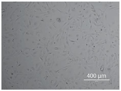 Phase Contrast Microscopy Of Primary Phyllodes Tumor Cells An Image Of Download Scientific