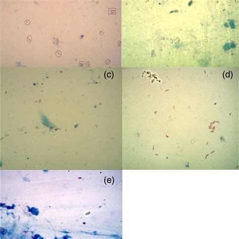 Pdf Ziehl Neelsen Sputum Smear Microscopy Image Database A Resource To Facilitate Automated