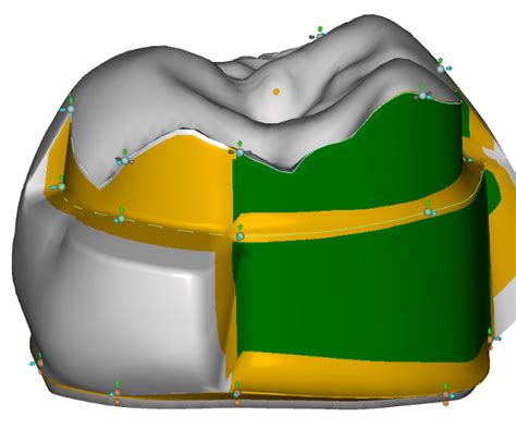 Exocad Información Básica Y Extensiones De Archivo Asociadas File Extension