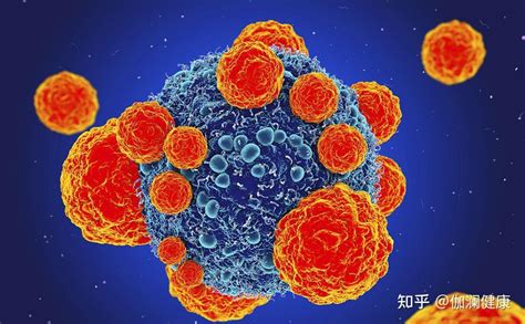热休克蛋白gp96为健康人防癌抗癌、肿瘤患者干预开辟新路径 知乎