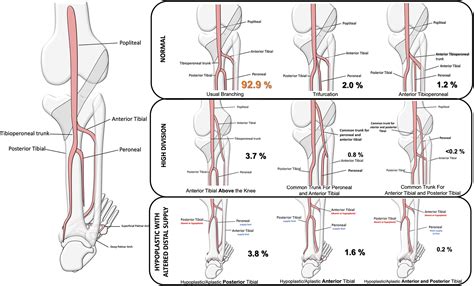 Tibialis Anterior Artery