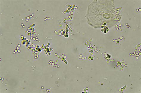 Automatic Yeast Cell Counter Oculyze