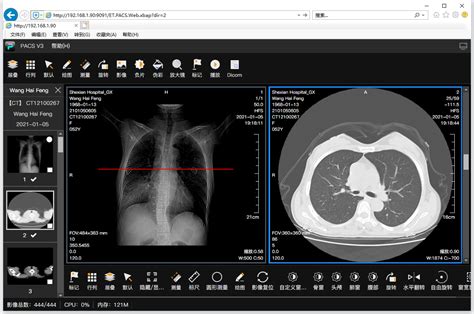 罗万pacs影像系统 webpacs html5