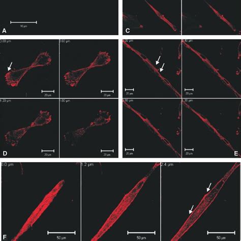 Immunocytochemical Localization Of Integrin A3 Subunit At Various