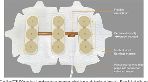 NovoTTF A Device Semantic Scholar