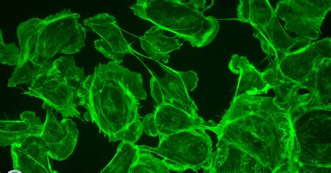 Microscope World Blog Fluorescence Microscopy