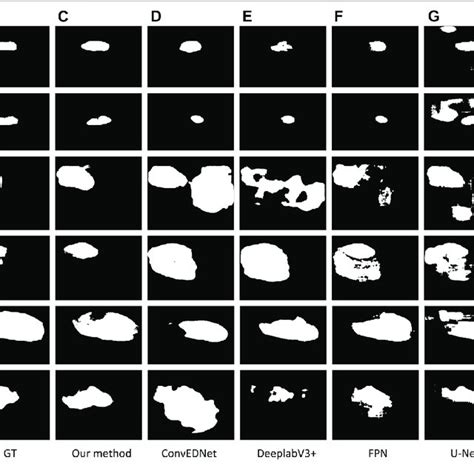 Comparison Of Breast Lesion Segmentation Between Our Approach C And