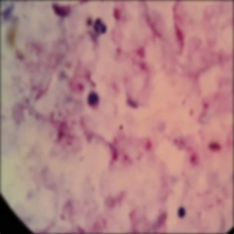 Gaussian 3 Object Detection Dataset By Michael Kosasih