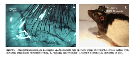Elon Musks Neuralink Says Its Created Brain Reading Threads