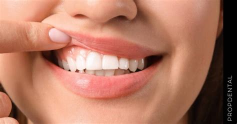 Sangre En El Glande Causas Y Tratamiento