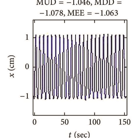 Example Of Typical Regular Respiratory Pattern Respiratory Pattern Of