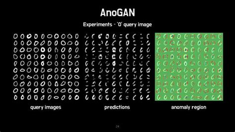 Unsupervised Anomaly Detection With Generative Model Ppt