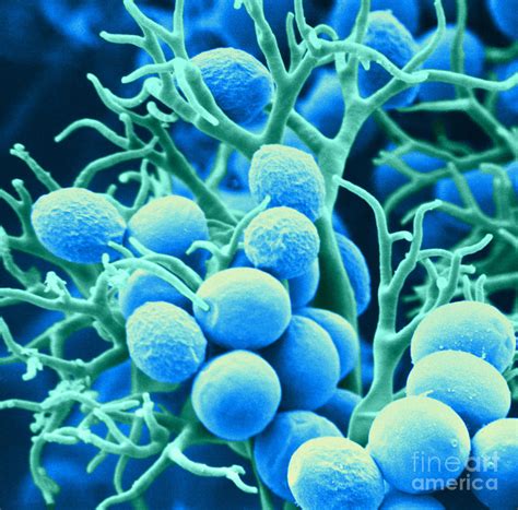 Peronospora Parasitica Photograph By Biophoto Associates And Photo