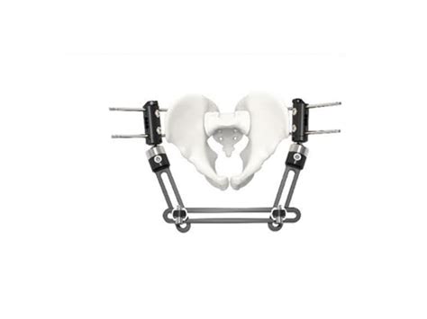 Pelvic External Fixator Manufacturer Yubmedtech