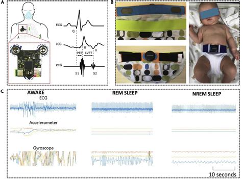 Recent Advances In Wearable Sensors And Portable Electronics For Sleep Monitoring Iscience