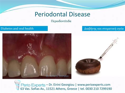 Periodontal Disease Diagnosis Prevention Treatment Pptx
