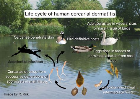 Swimmers Itch Life Cycle Swimmers Itch North Bay Parry Sound
