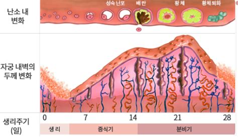 자궁벽 두께 변화 월경 주기 따른 자궁내막 두께 차이 출혈 유발하는 증상 관련 정보