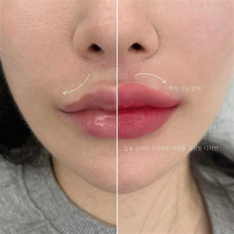 강남입술문신 입술문신 입술반영구 립라인 입술문신수강 アートメイク 로제이뷰티아카데미 대표원장 🕋 수년간의 경험과 연구를 통해 찾은 립라인 확장에 가장 적합한 색소를
