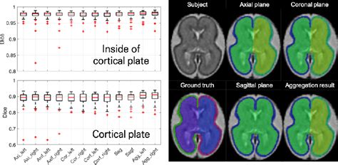 frontiers fetal cortical plate segmentation using ful