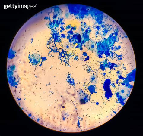 Streptococcus Pyogenes And Pneumonia Bacteria Micrograph 이미지 2161637766 게티이미지뱅크