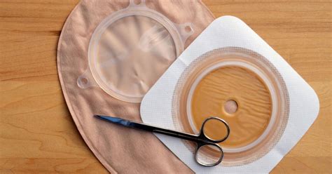 Understanding Ostomy Skin Care