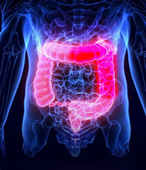 Ulcerative Colitis Diagnosis And Treatment Services In India Desai Surgical