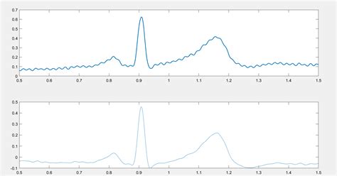 Github Zineb 212tp3 Traitement D Un Signal Ecg