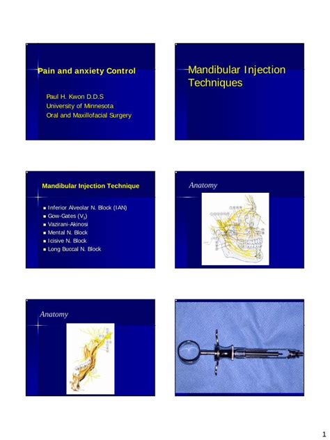 Pdf Mandibular Injection Techniques Dokumentips