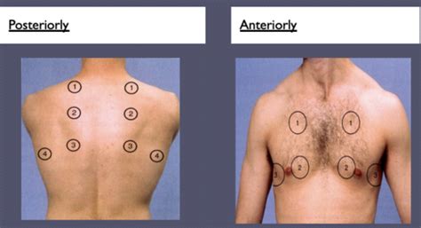 The Pulmonary Physical Exam Flashcards Quizlet