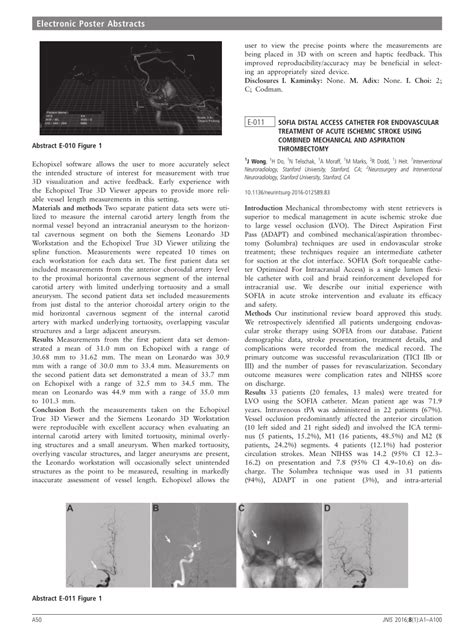 Pdf E 011 Sofia Distal Access Catheter For Endovascular Treatment Of