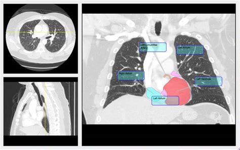 Chestanatomy Mac玩儿法 Mac软件推荐 Mac软件评测 Mac软件下载