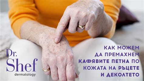 Как можем да премахнем кафявите петна по кожата на ръцете и деколтето Youtube