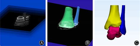 From Ct Image To Digital 3d Model Construction A Ct Cross‐sectional Download Scientific