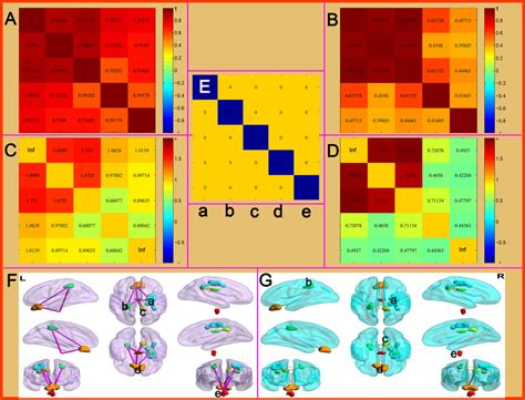 Findings Of Fc Analysis Roi Wise In Five Brain Regions With Altered Download Scientific