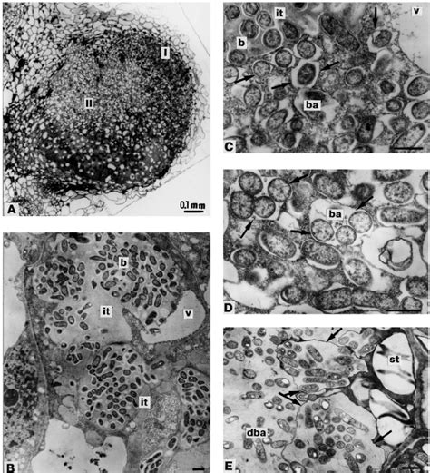 Nodule Structural Organisation Of Mutant Risfixa A Longitudinal Download Scientific Diagram
