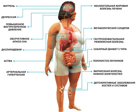 Капсулы Кето Диета официальный сайт на русском языке