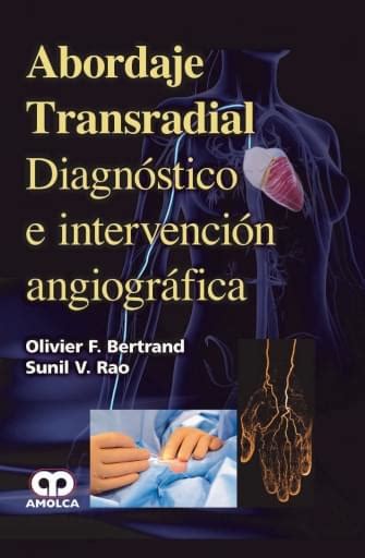 Abordaje Transradial Diagnóstico E Intervención Angiográfica