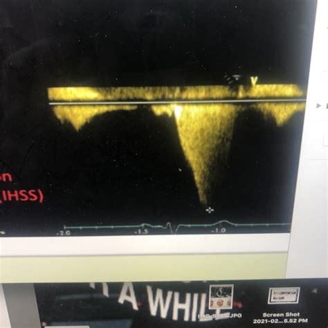 Echo Chap 34 Flashcards Quizlet