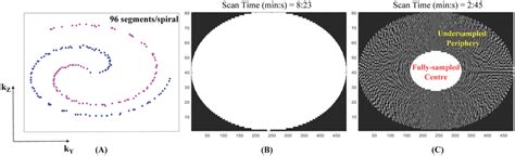 a cartesian spiral‐like sampling of the 3d centric caspr trajectory