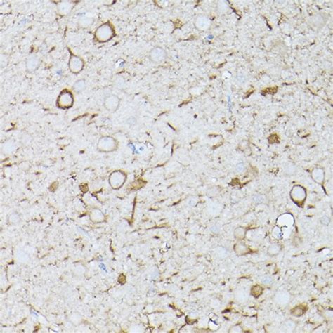 Anti Interferon Alphabeta Receptor 1 Antibody A308248