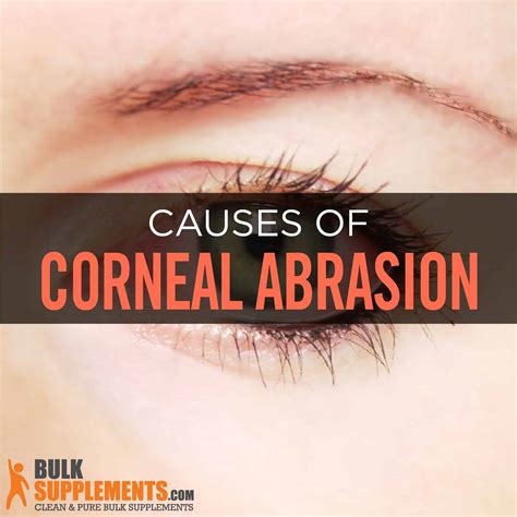 Corneal Abrasions Causes Symptoms And Treatment Swlhhe